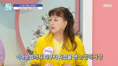 눈 바깥쪽 주름이 심하다면?!, MBC 230906 방송 | 네이트 TV