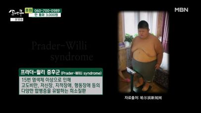 끝없는 허기, 프라더-윌리 증후군 MBN 240309 방송 | 네이트 TV