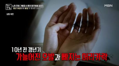 노화 유발 마지막 탈주범, 탈모 MBN 240126 방송 | 네이트 TV