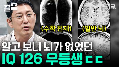 IQ 126인 소년의 뇌 95%가 없다고? 뇌가 없으면 장기의 신경 세포가 기억을 한다는데..🫢 의학적으로 정확히 설명할 수 ...