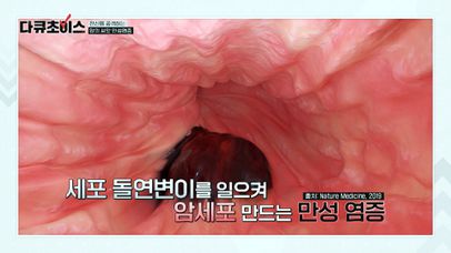 노화도 질병💥 전신을 공격하는 무서운 만성염증😱 | JTBC 231125 방송 | 네이트 TV