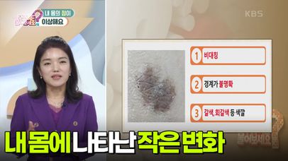 [닥터의 경고] 내 몸의 점이 이상해요! | KBS 250519 방송 | 네이트 TV